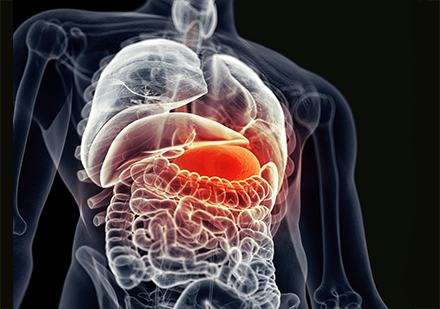 Functional dyspepsia - Australian Prescriber