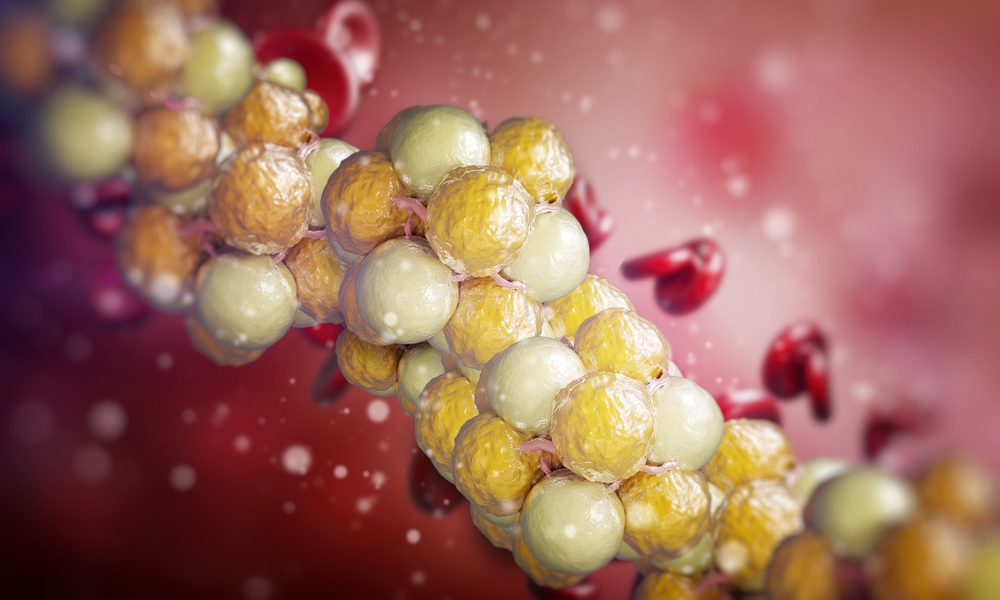 Managing lipids - NPS MedicineWise